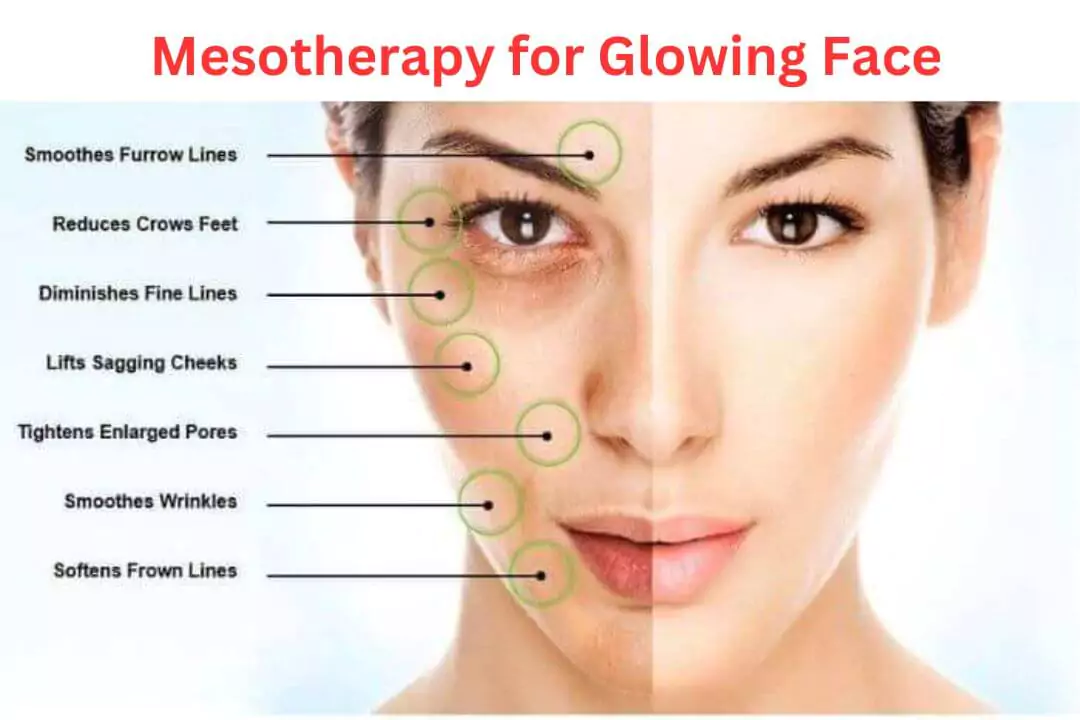 Mesotherapy Face Glow Treatment Ambala | Jindal Aesthetics